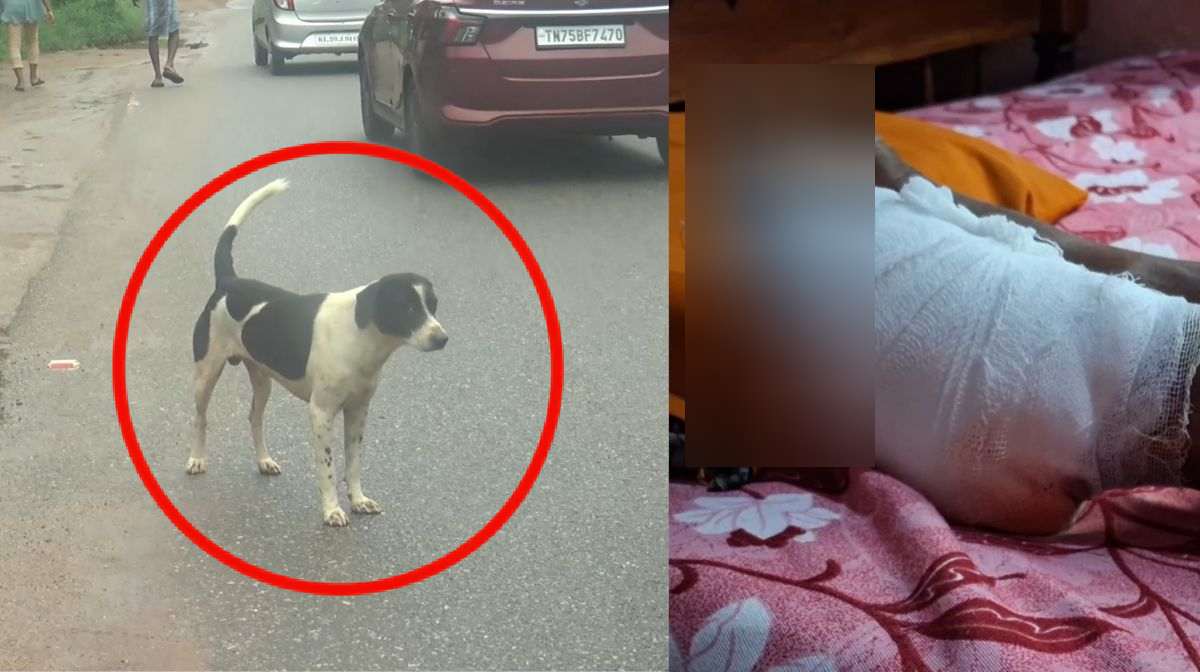 വീട്ടിൽക്കയറി വീട്ടമ്മയുടെ വിരൽ കടിച്ചെടുത്ത് തെരുവുനായ; 4 പേര്‍ക്ക് ...