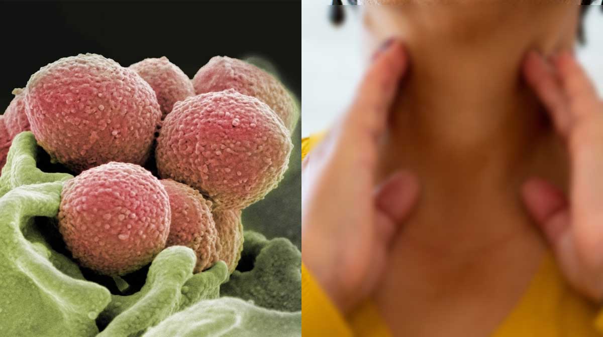 ശരീരത്തില്‍ കടന്നാല്‍ 48 മണിക്കൂറില്‍ മരണം ഉറപ്പ്; ഭീതി പടര്‍ത്തി ...