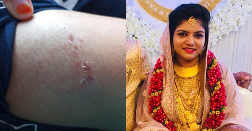 Dowry Death|വീണ്ടും സ്ത്രീധന പീഡനം? തിരുവനന്തപുരത്ത് യുവതി ജീവനൊടുക്കി ...