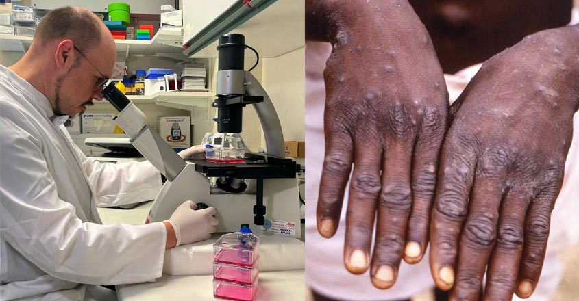 Monkey flu: three-week quarantine in the UK; Smallpox vaccine claims to ...