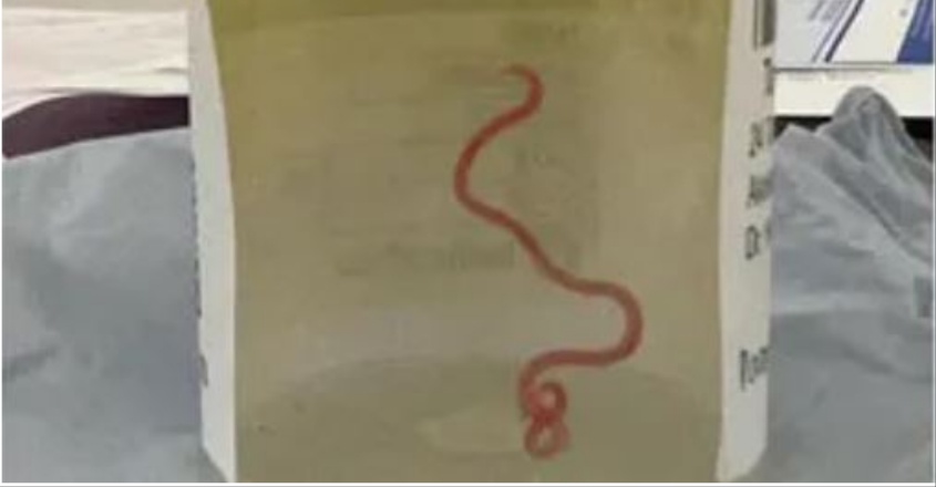 Uncovering the Shocking Discovery: Ophidascaris Robertsi Worm Found in ...